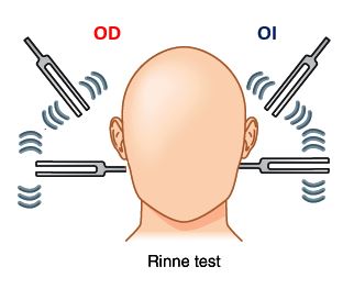 Acumetría – EL RINCÓN DEL AUDIÓLOGO
